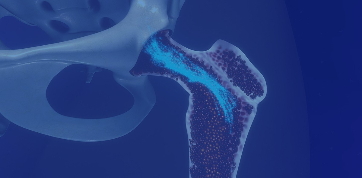 Unlocking the Power of Healing: The Journey of Bone Marrow Transplants ...